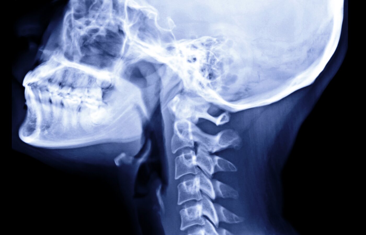 Jaw Alignment and Posture: Supporting Whole-Body Harmony - Santa Teresa ...